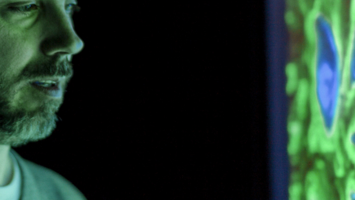 Biogen/Eisai: Alzheimer-Antikörper zeigt Wirkung