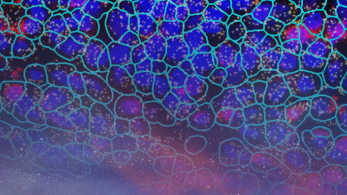 Bruker gewinnt Auktion um NanoString